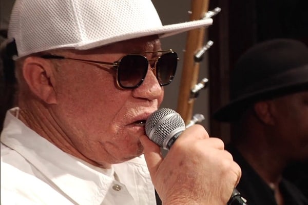 Famous Albino People You Should Know