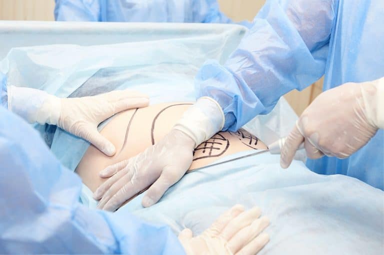 12 of the World’s Most Dangerous Surgeries